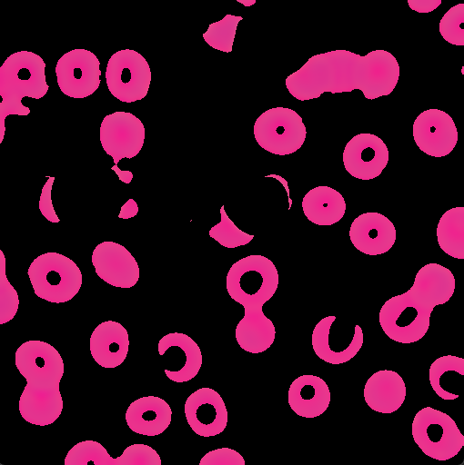 GitHub - petermervart/RedBloodCellsDetection