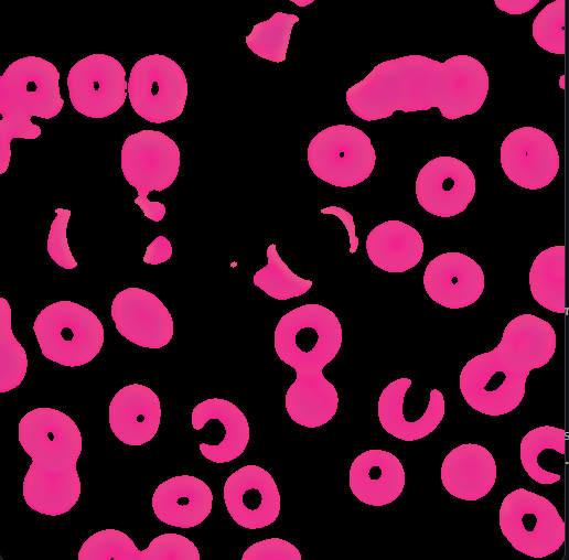 GitHub - petermervart/RedBloodCellsDetection