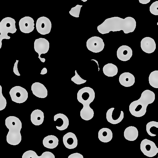 GitHub - petermervart/RedBloodCellsDetection