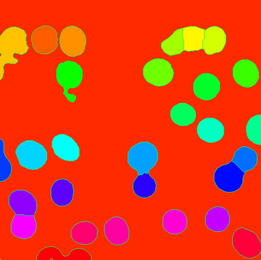 GitHub - petermervart/RedBloodCellsDetection