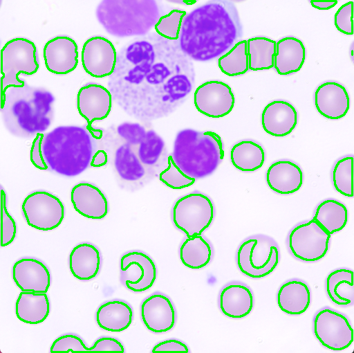 GitHub - petermervart/RedBloodCellsDetection