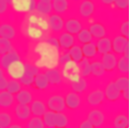 GitHub - petermervart/RedBloodCellsDetection