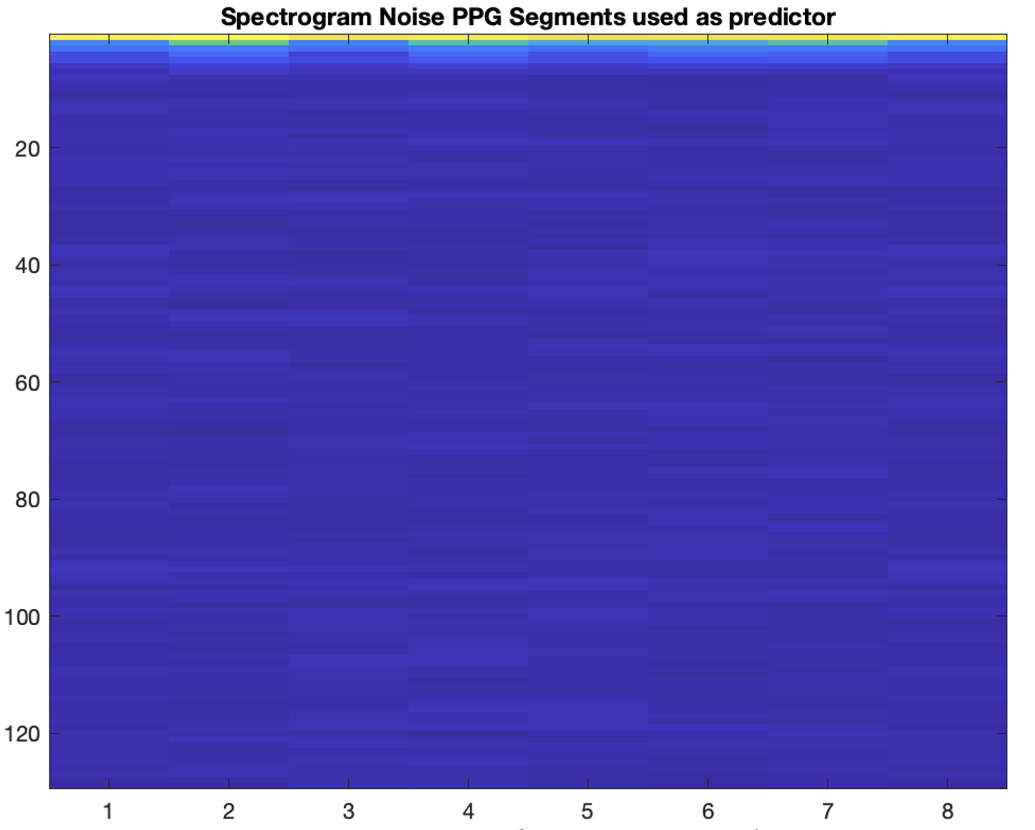 GitHub - larryTheran/DenoiseDeepPPG