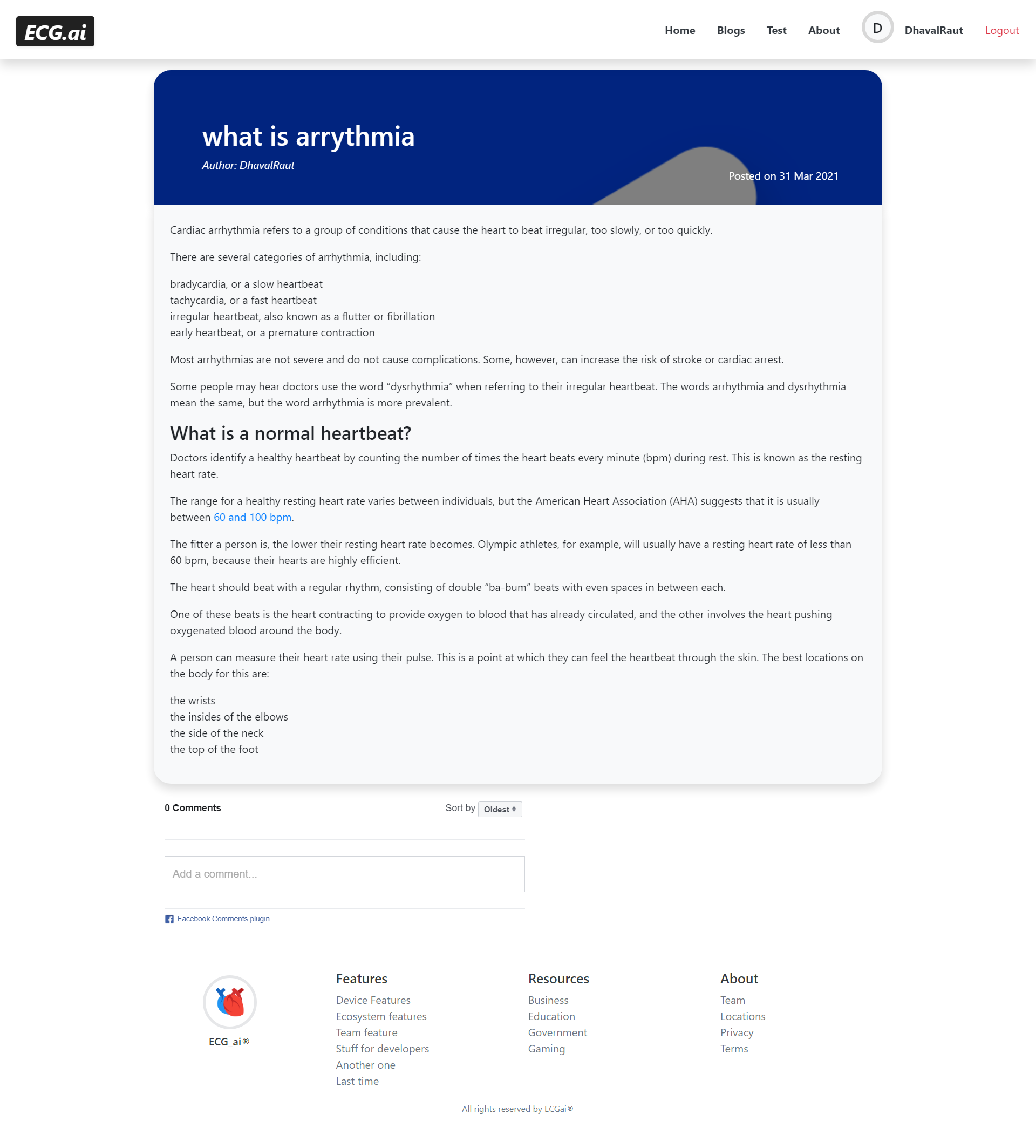 GitHub - dhavalrauttech/ECG-ai: Web app MERN stack