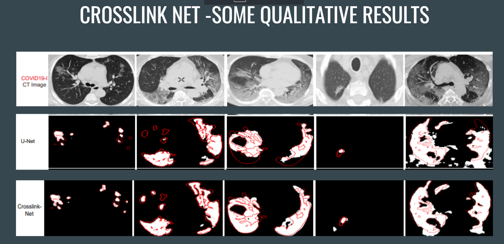 GitHub - Kushagra132/Skin-Lesion-And-Wound-Segmentation GitHub - Kushagra132/Skin-Lesion-And-Wound-Segmentation