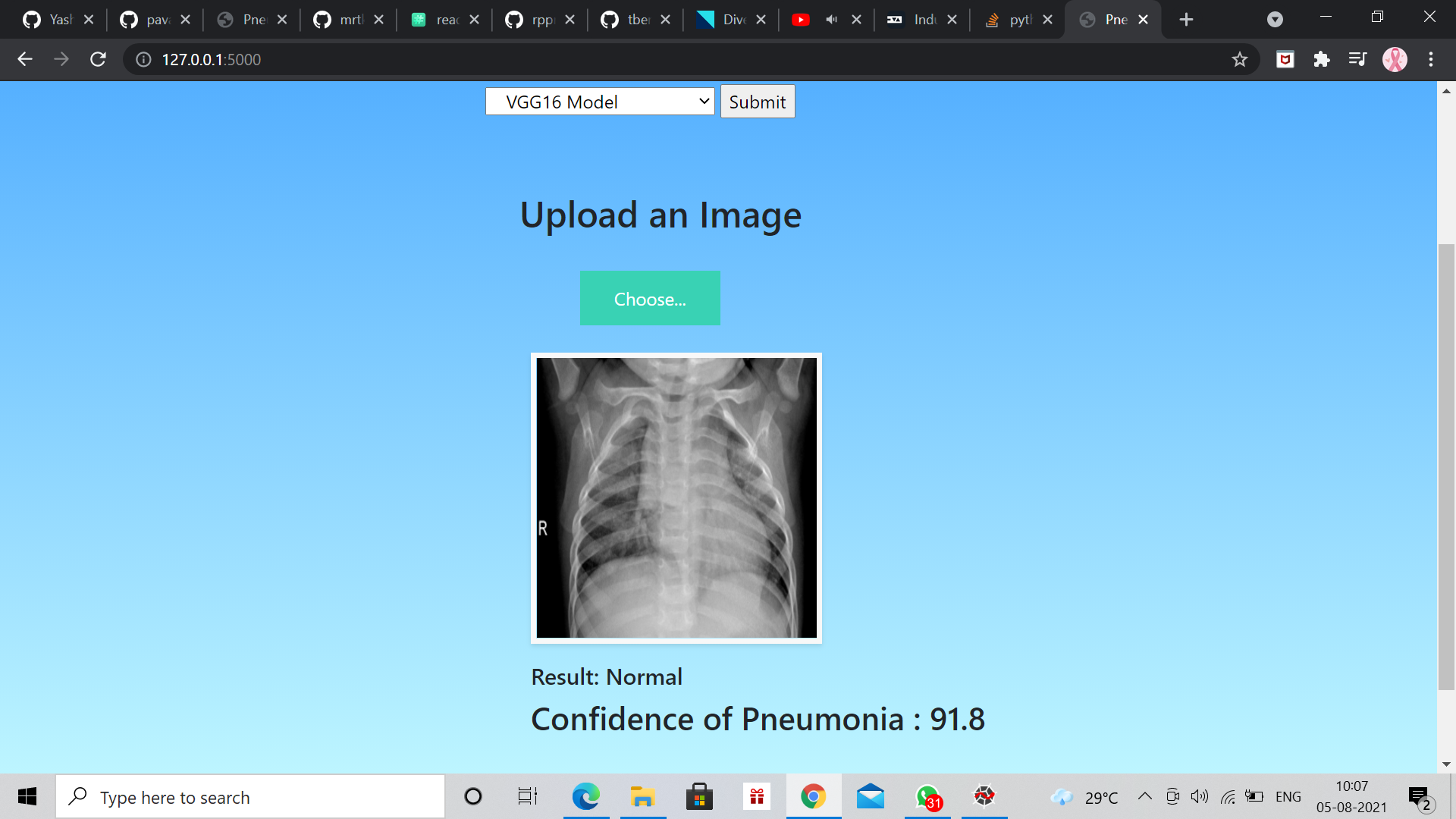 GitHub - Tijo2000/Pneumonia-detection-web-app: Pneumonia detection web ...