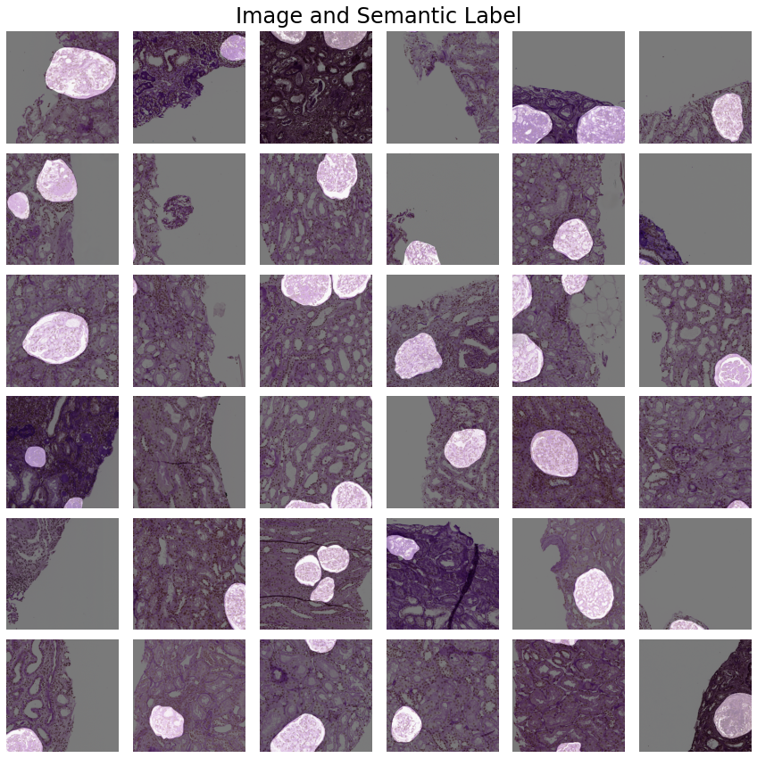 GitHub - WOE-Y/openmmlab