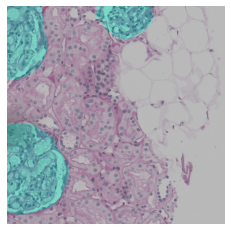 GitHub - WOE-Y/openmmlab