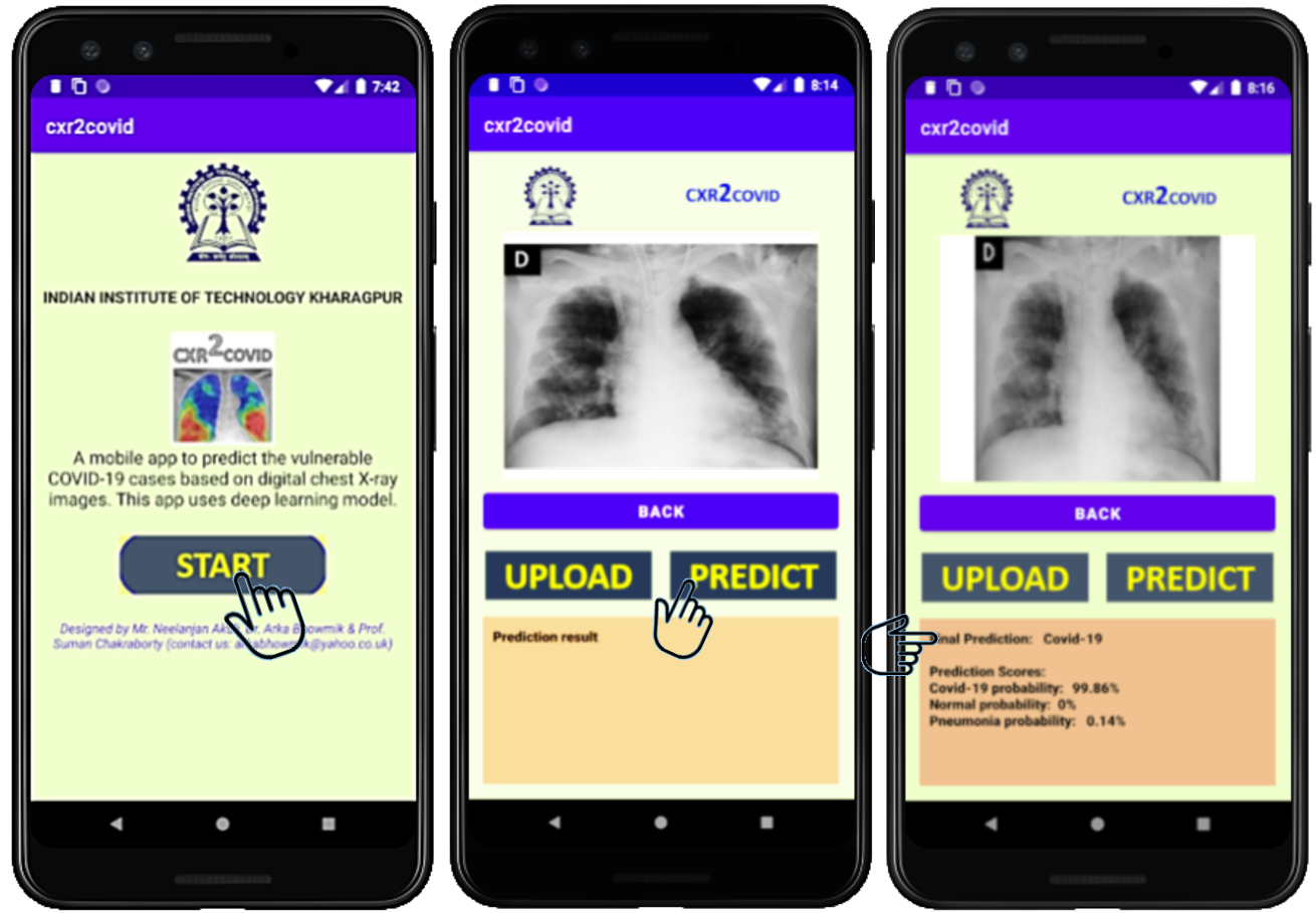 GitHub - Arka-Bhowmik/DL_smart_phone_application_Chest_X_ray: AI enabled smartphone application ...