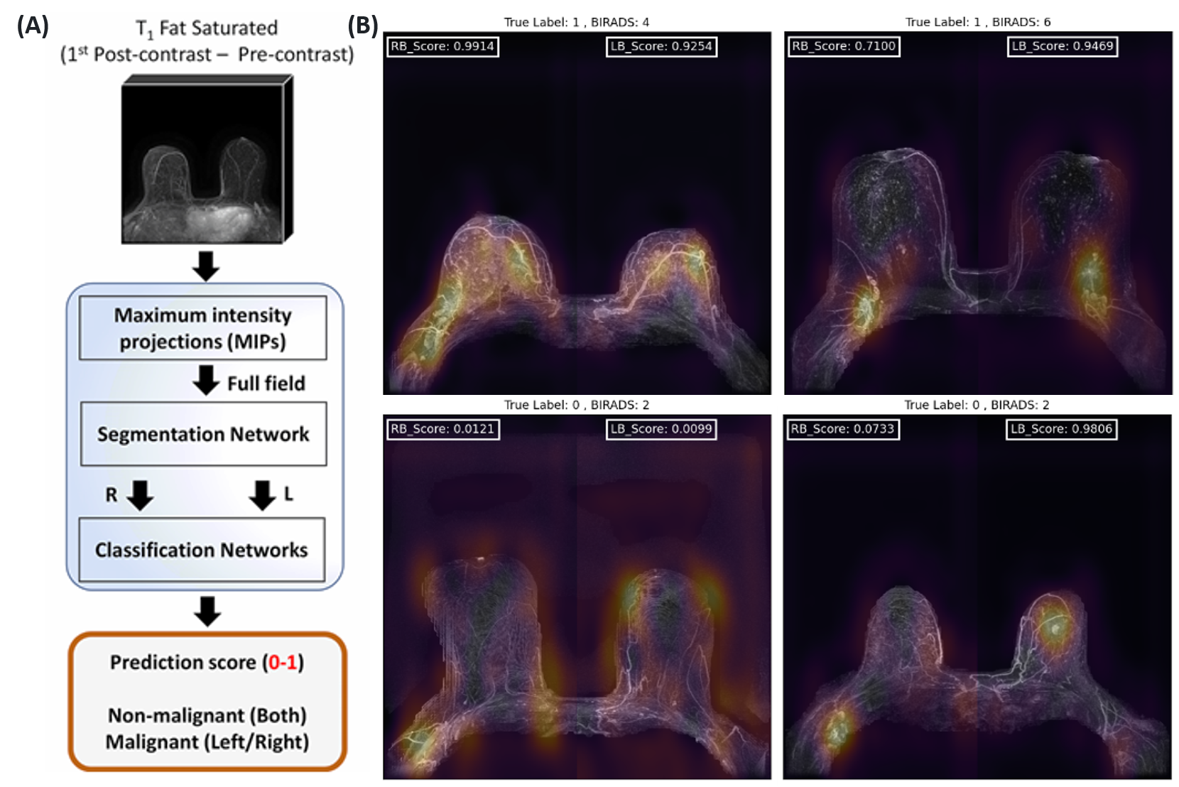 GitHub - Arka-Bhowmik/mri_triage_normal: Deep Learning Breast MRI ...