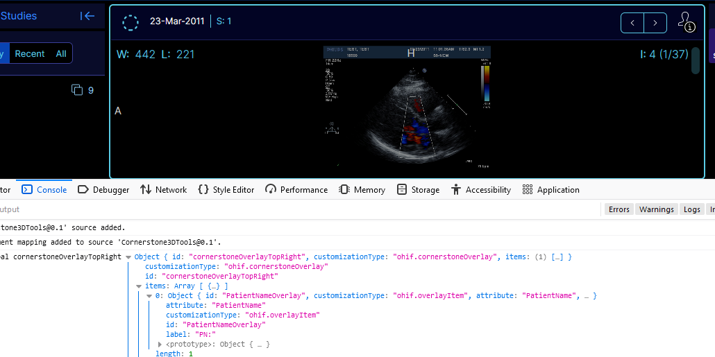 Ohif V3 Add Image Overlay In Viewport · Issue 3144 · Ohifviewers