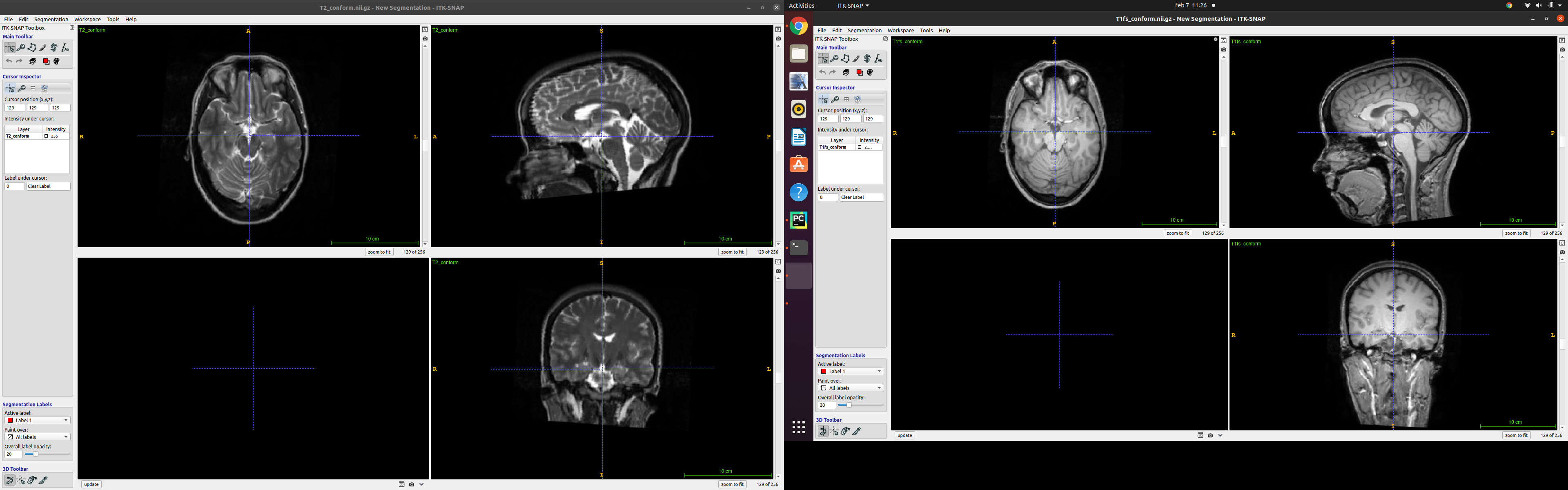 Headreco in the case of different image coverage between T1 and T2. · Issue #75 · simnibs ...