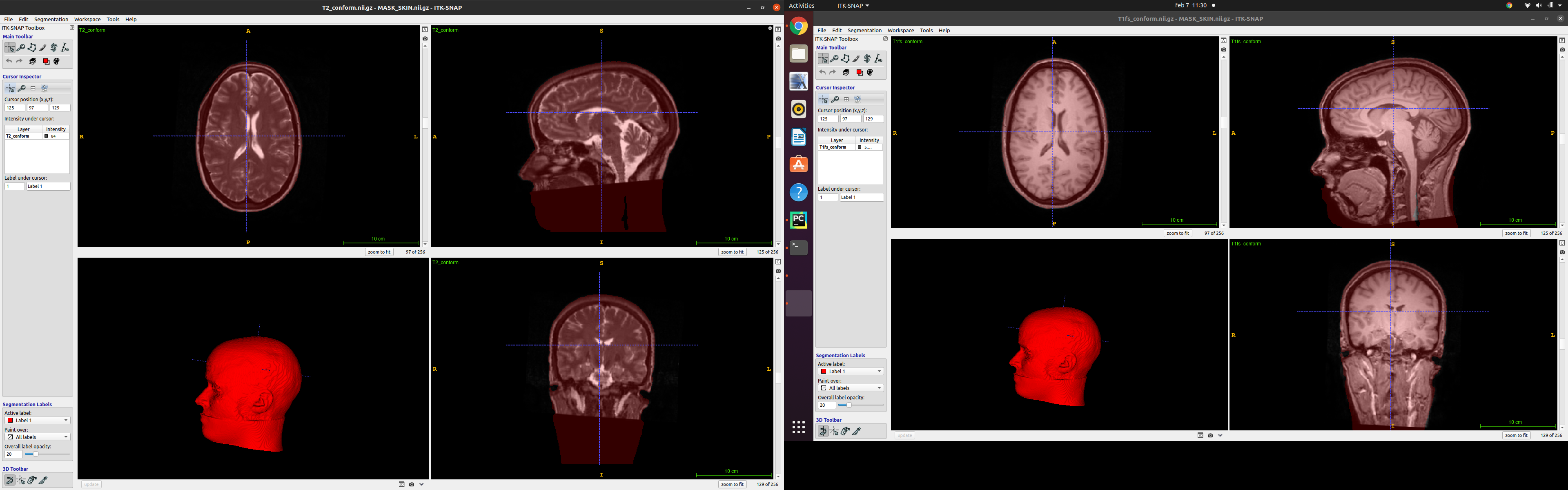 Headreco In The Case Of Different Image Coverage Between T1 And T2 · Issue 75 · Simnibs