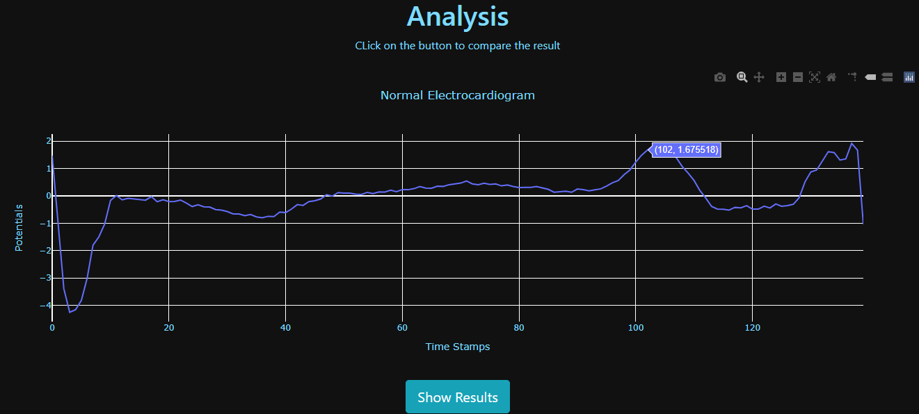 GitHub - HOTSONHONET/EasyBeat: A webapp that takes patients ECG readings from their wearable ...