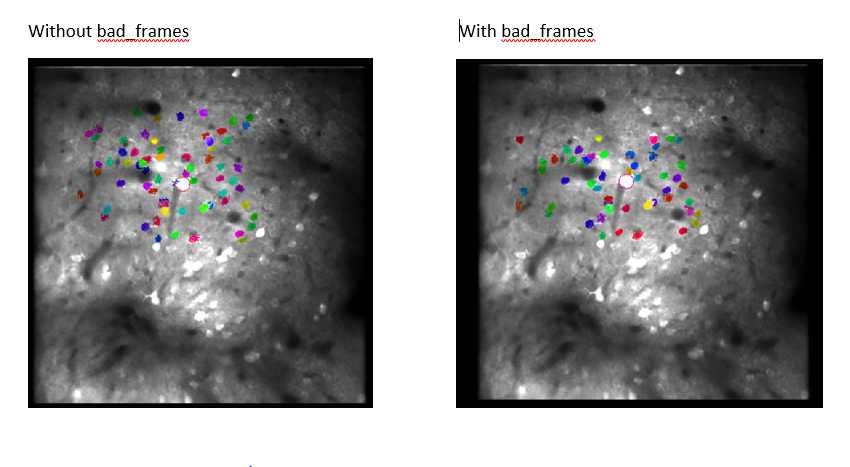 Errors with using data saved in ImageJ · Issue #273 · MouseLand/suite2p · GitHub