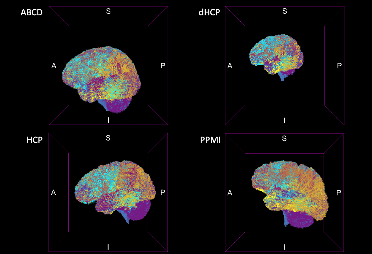 GitHub - SlicerDMRI/TractCloud: [MICCAI 2023] TractCloud: Registration-free tractography ...