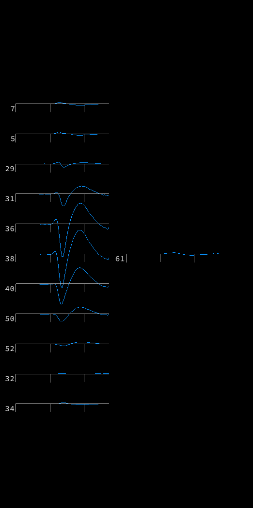 waveform view scaling difference between raw and mean or template · Issue #908 · cortex-lab/phy ...