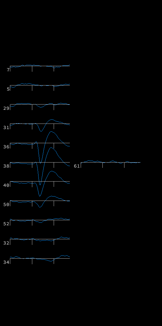 Waveform View Scaling Difference Between Raw And Mean Or Template · Issue 908 · Cortex Labphy 