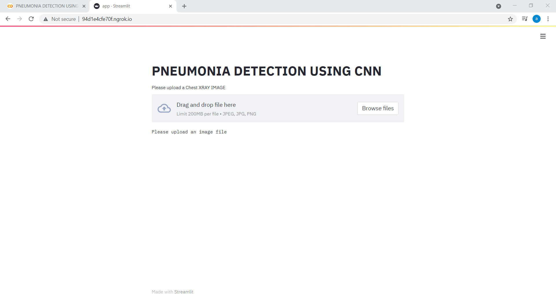 Github Ankithsinghmalik Pneumonia Detection The Aim Of The Project