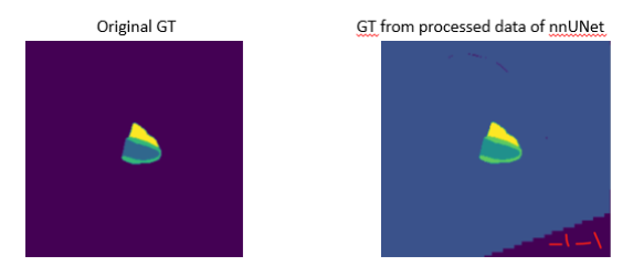 nnUNetv2_plan_and_preprocess-- Issues for 2D datasets · Issue #1637 · MIC-DKFZ/nnUNet · GitHub