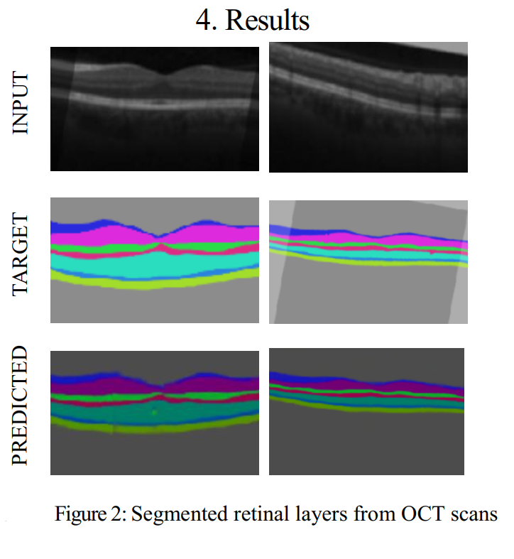 GitHub - kabbas570/Retinal-Layers-segmentation-to-analyzie-retinal-anomalies