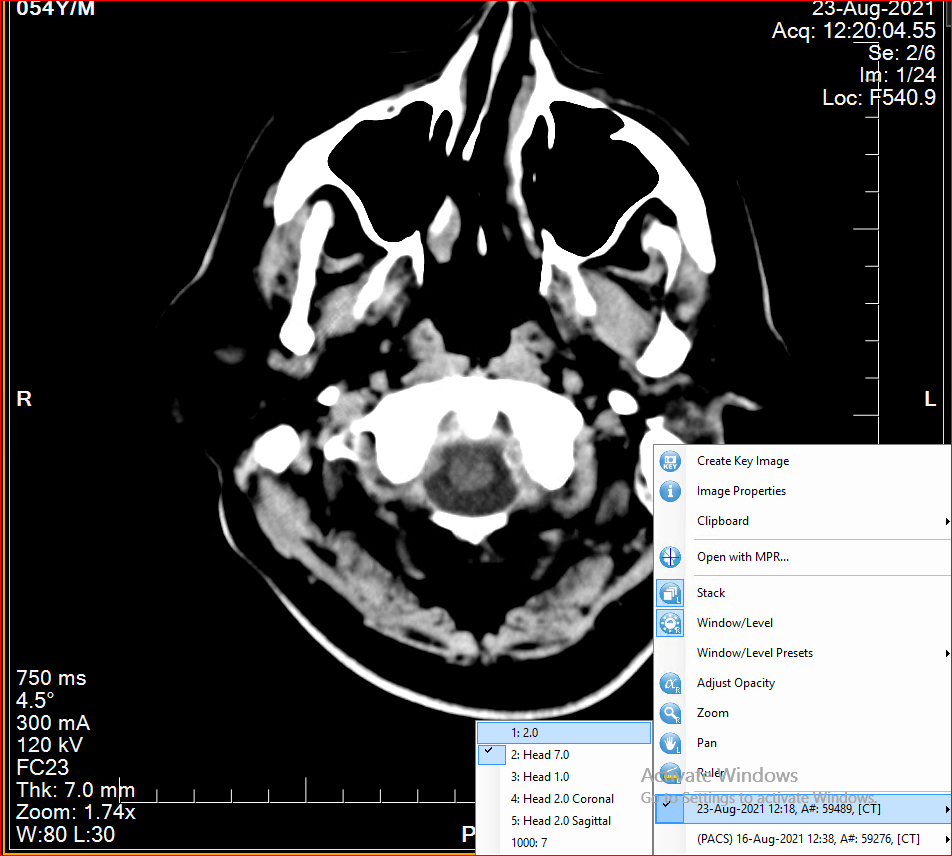 Series Description is not shown in Context Menu · Issue #272 ...