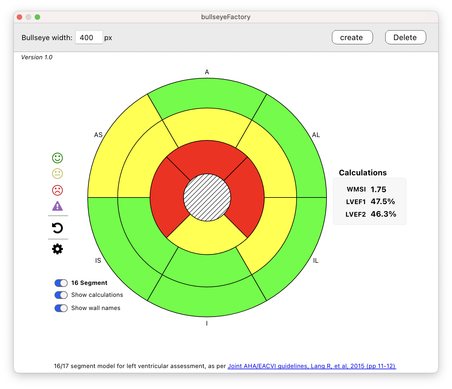 GitHub - stam66/bullseyeFactory: LiveCode IDE plugin to create a bullseye for left ventricular ...
