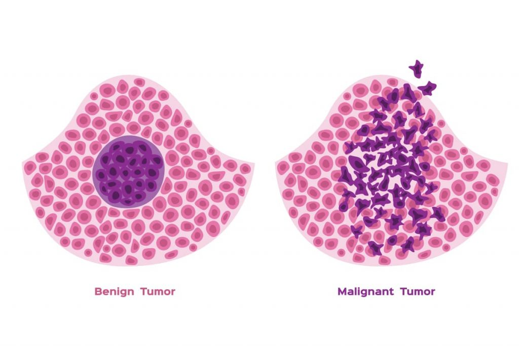 GitHub - SyahabKadir/Classification---Breast-Cancer-Diagnostic ... GitHub - SyahabKadir/Classification---Breast-Cancer-Diagnostic ...