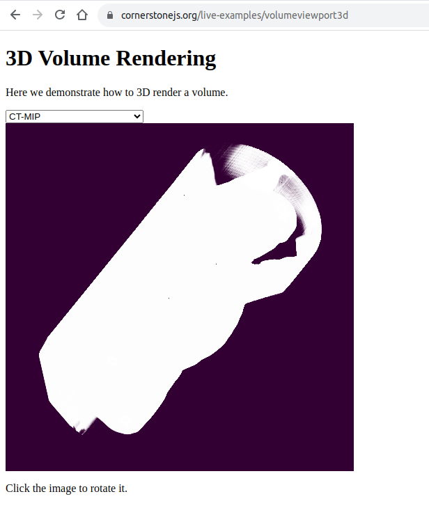[Bug] MIP Presets: Saturation Issue in 3D Viewport · Issue #797 · cornerstonejs/cornerstone3D ...