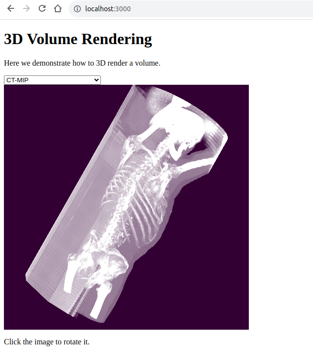 [Bug] MIP Presets: Saturation Issue in 3D Viewport · Issue #797 · cornerstonejs/cornerstone3D ...