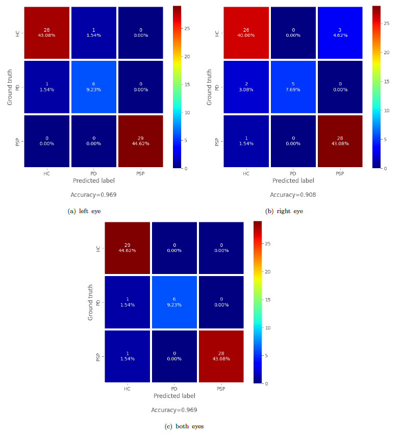 GitHub - Hammoudmsh/Neurological-disease-diagonisis-through-NIR-eye-video