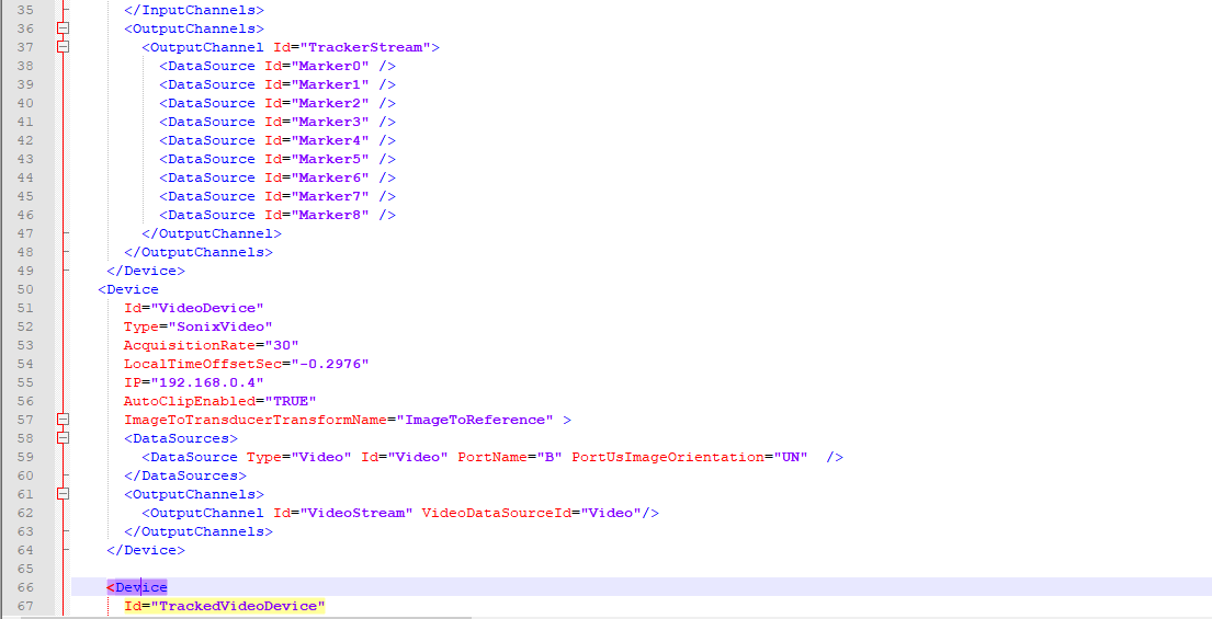 Scout scanning and live reconstruction · Issue #665 · PlusToolkit/PlusLib · GitHub