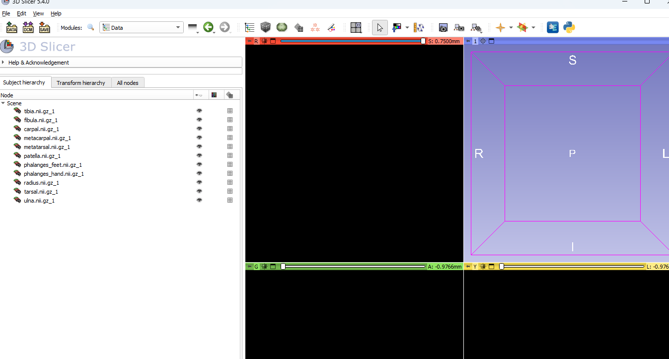 Appendicular_bones not showing anything · Issue #187 · wasserth/TotalSegmentator · GitHub