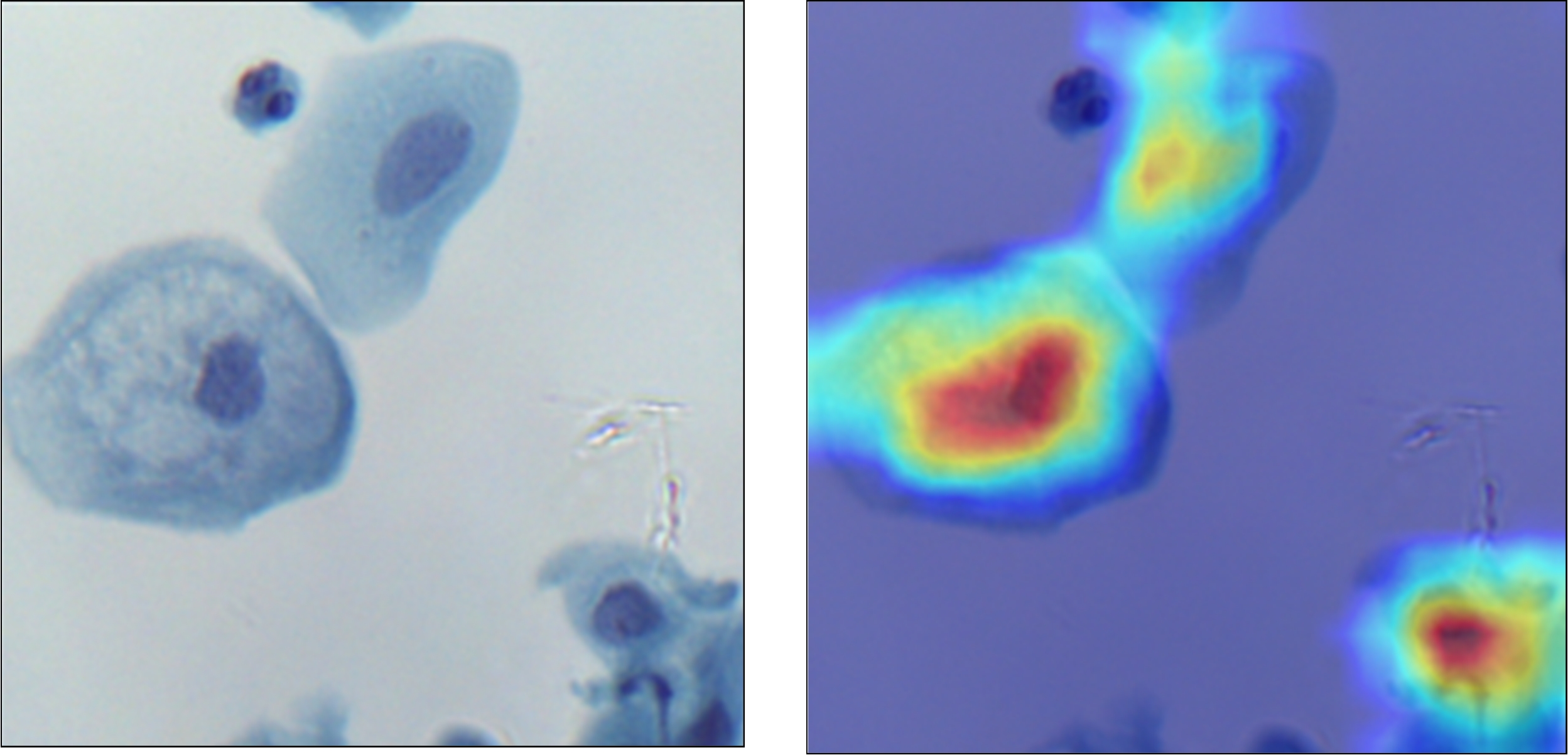 GitHub - AnwarKhan345/CervixFormer: A Multi-scale Swin Transformer-based Cervical Pap-Smear WSI ...