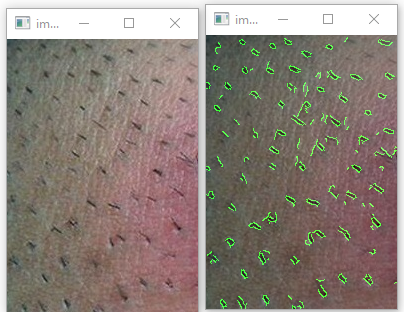 GitHub - OOmerKerem/HairRootDetection: Hair Root Detection with Image ...