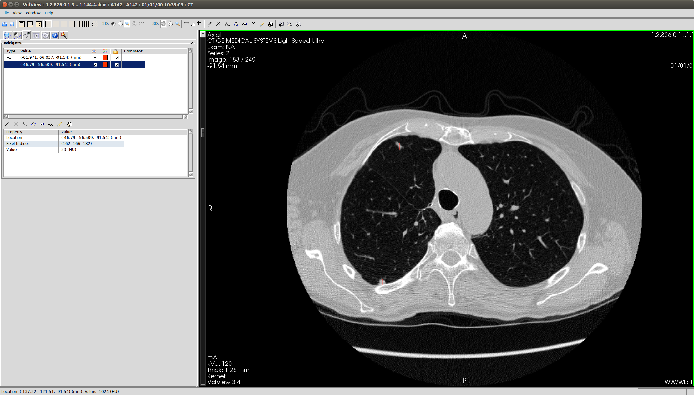 GitHub - accumetra/ACM-LSTK