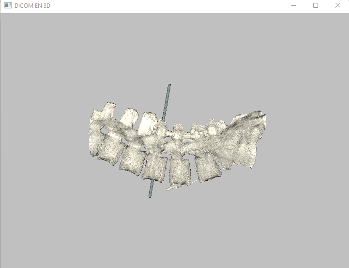 GitHub - JCM01/dicomPython: Extracting metadata from DICOM files and converting them into 2D and ...