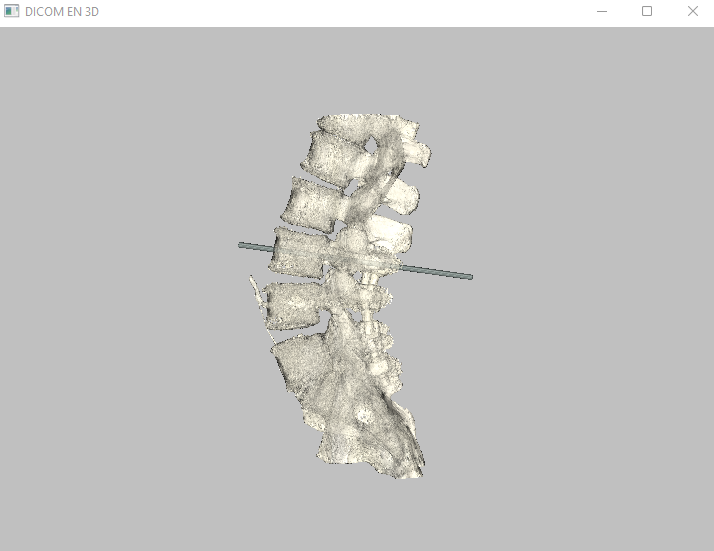 GitHub - JCM01/dicomPython: Extracting metadata from DICOM files and converting them into 2D and ...