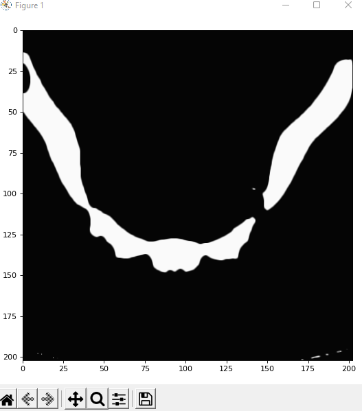 GitHub - JCM01/dicomPython: Extracting metadata from DICOM files and ...