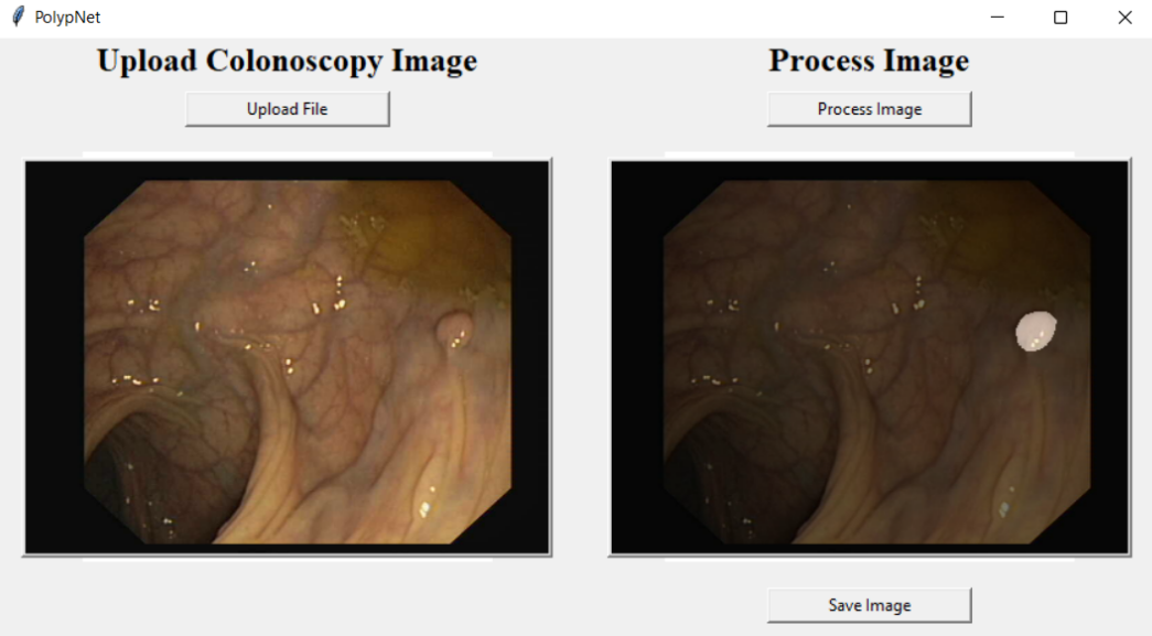 GitHub - jtcarrion/PolypNet: Lightweight GUI designed to identify and ...
