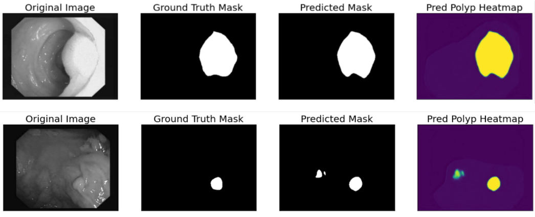 GitHub - jtcarrion/PolypNet: Lightweight GUI designed to identify and ...