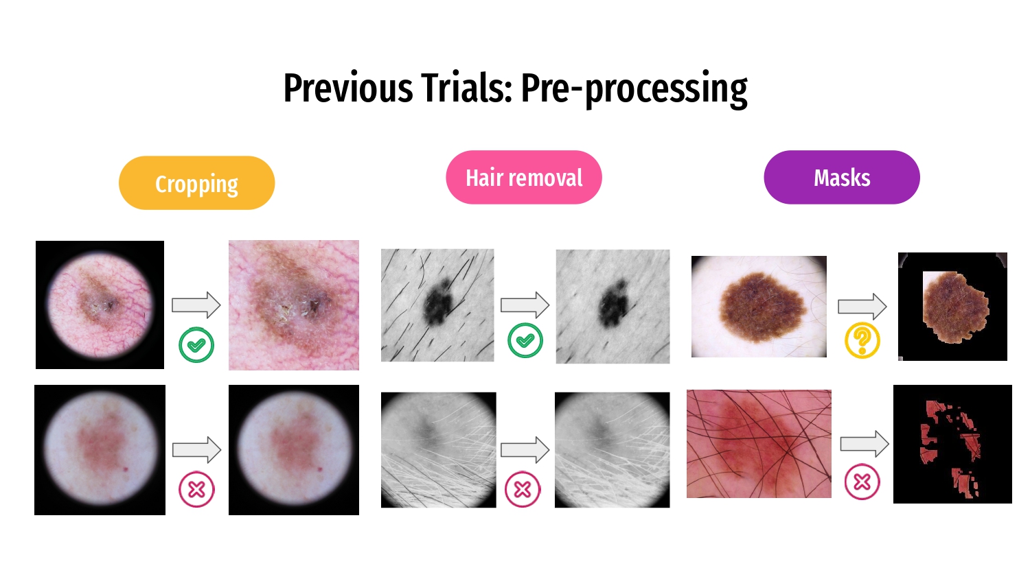 GitHub - amina-bzd/melanoma_classification: Skin lesions classification ... GitHub - amina-bzd/melanoma_classification: Skin lesions classification ...