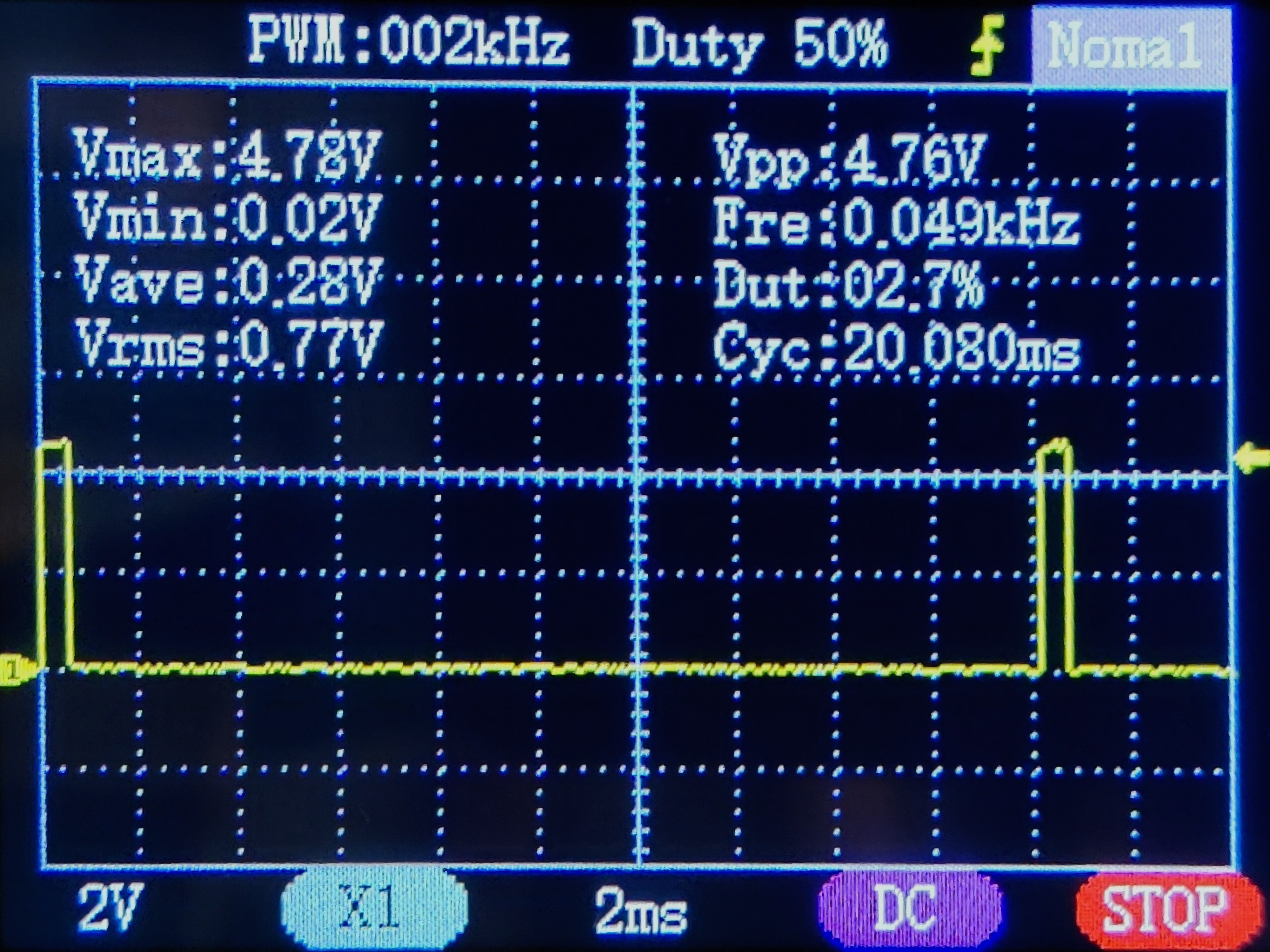 Github Brssko Lab2 Radiocontrol