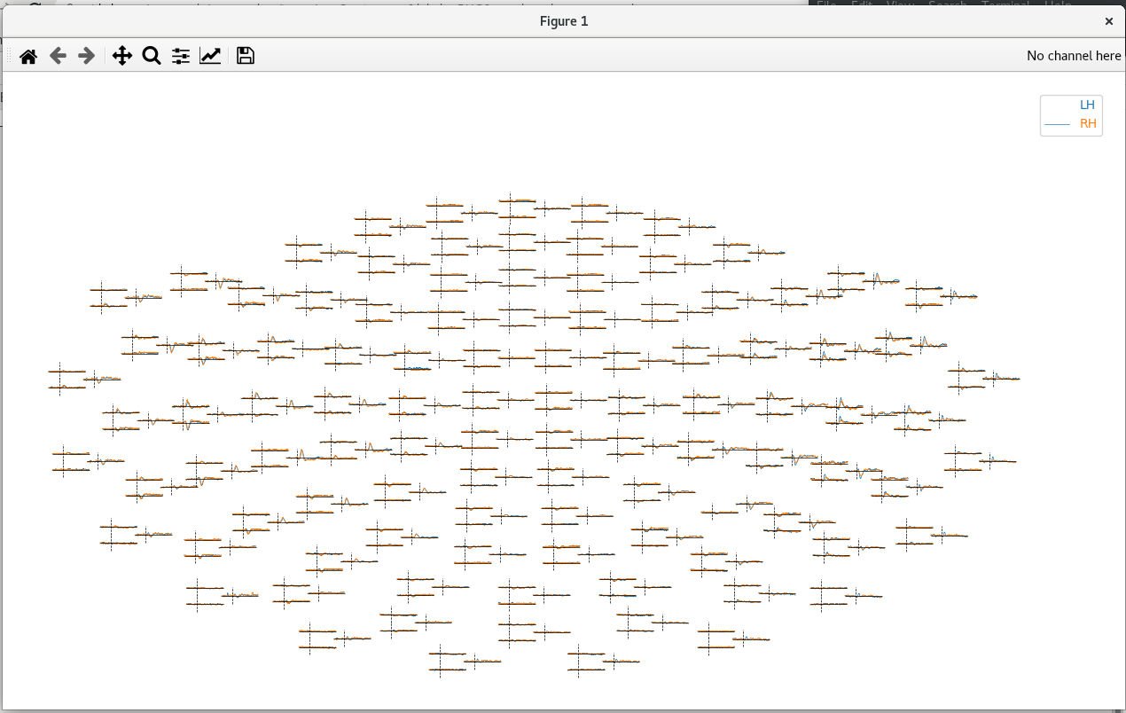 Legend colors misbehave on plot_evoked_topo · Issue #11258 · mne-tools/mne-python · GitHub