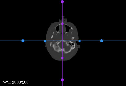 Windowlevel Is Not Correct · Issue 14 · Mix3dvue Vtkjs Viewport · Github 1804