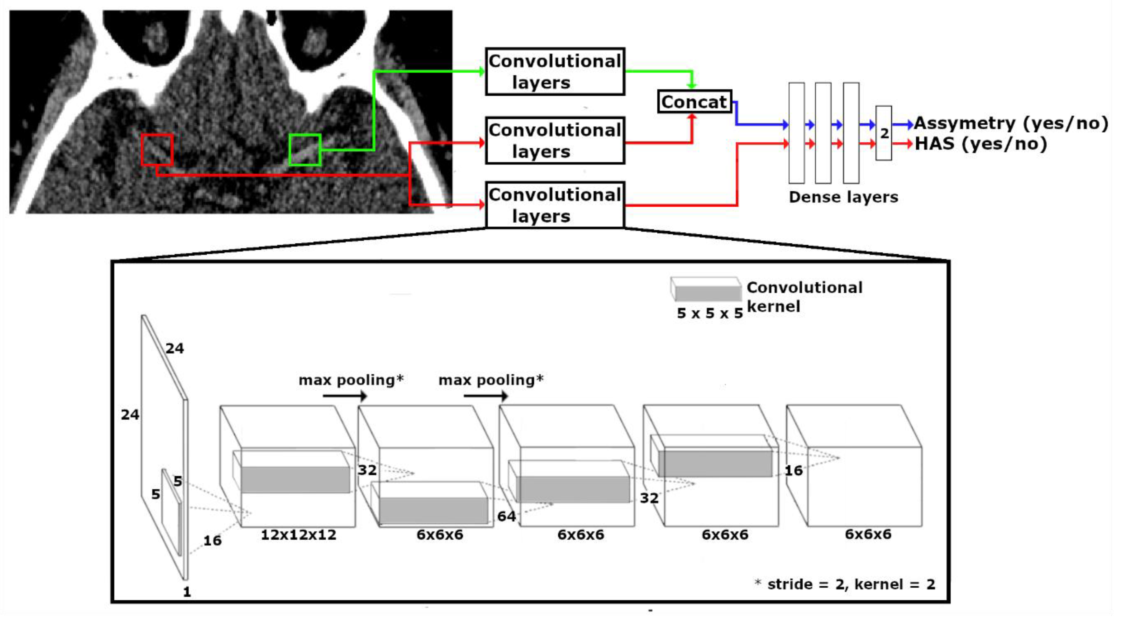 GitHub - Shrinidhi-C/Acute-Brain-Infarct-Location-Classification-Using ...