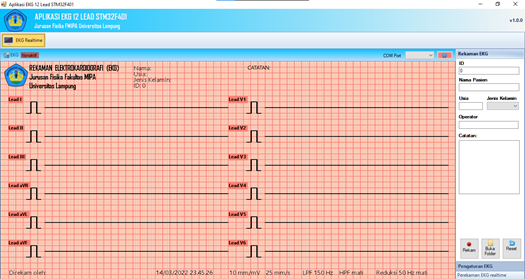 GitHub - reyhan-darmawan15/stm32f401-usb-ecg: STM32F401 based 12-Lead ECG with USB 2.0 Connectivity