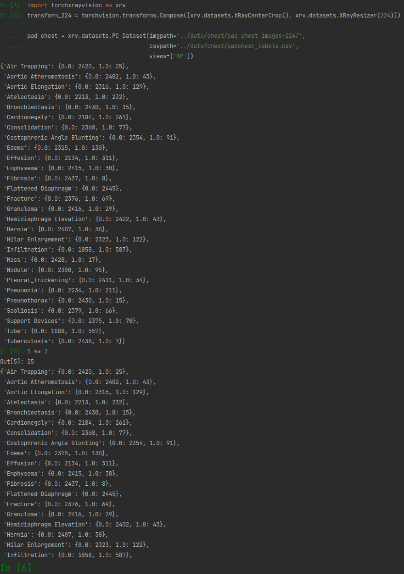 Console always prints dataset statistics · Issue #113 · mlmed/torchxrayvision · GitHub