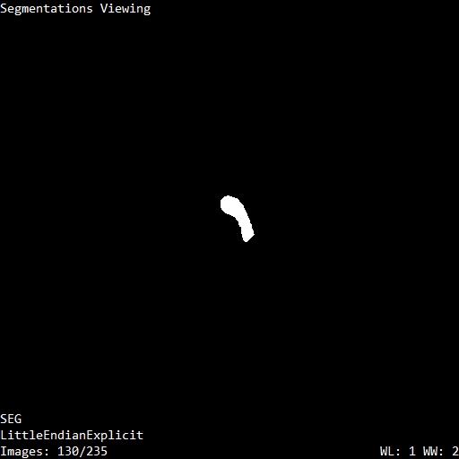 Monochrome2 segmentation frames are not exported out correctly · Issue ... Monochrome2 segmentation frames are not exported out correctly · Issue ...