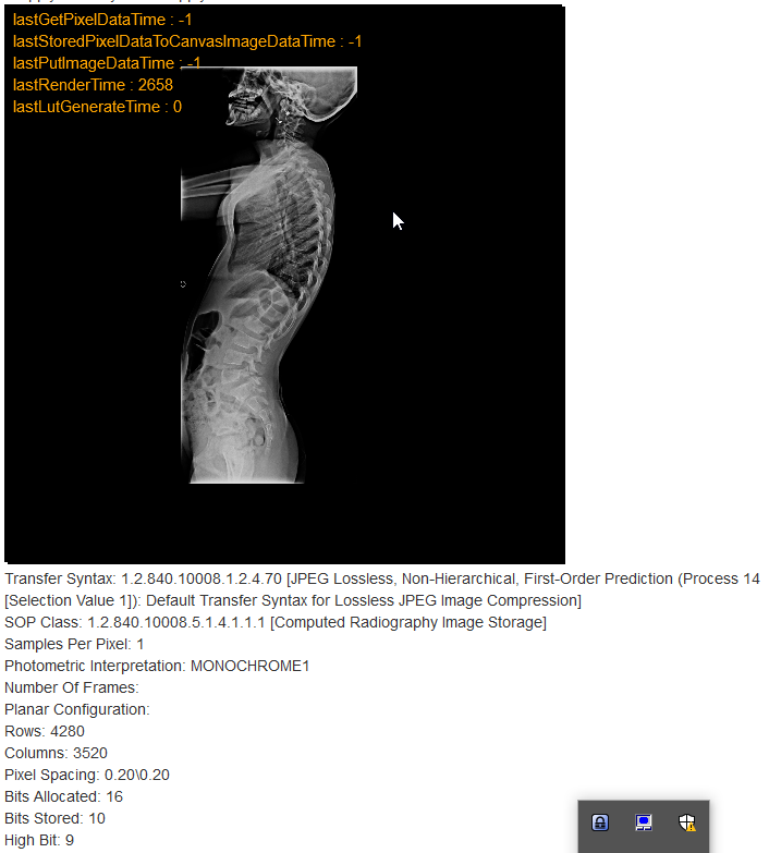 Error Webgl Warning Requested Size Was Too Large · Issue 140 · Cornerstonejscornerstone